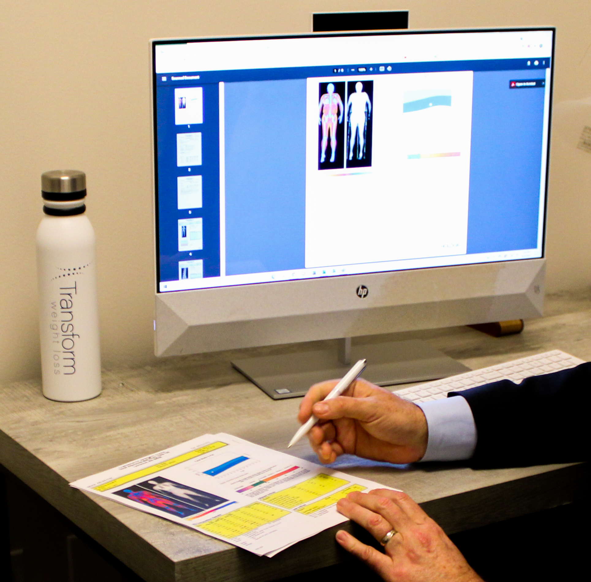 Biometrics - Transform Weight Loss